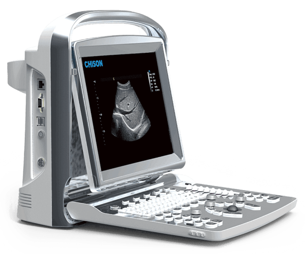 Ecógrafo Chison Eco 1 │Mi Equipo Médico Ecuador